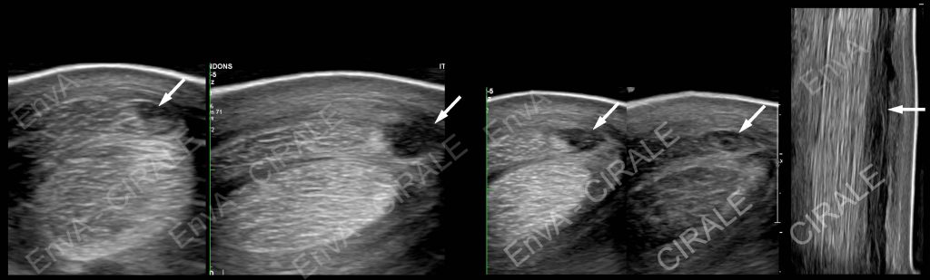 Low Frequency Ultrasound Therapy on a Horse with Tendinopathy of the ...